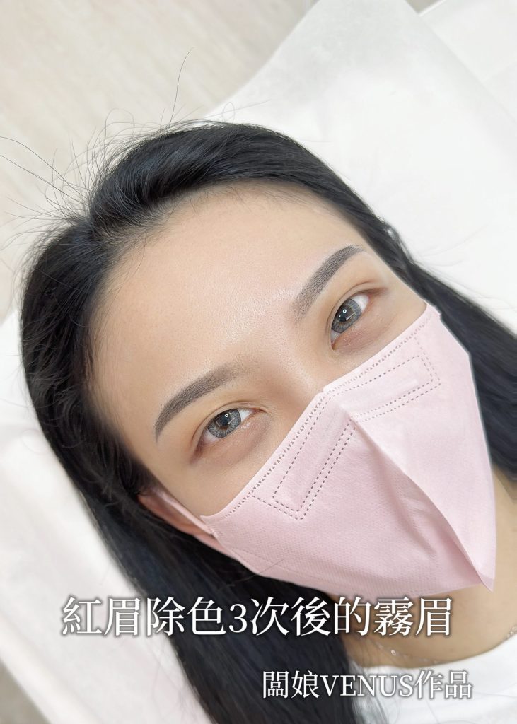 橘紅眉怎麼辦？快速了解成因與解決方法！- 維納斯美學 Venus Studio
